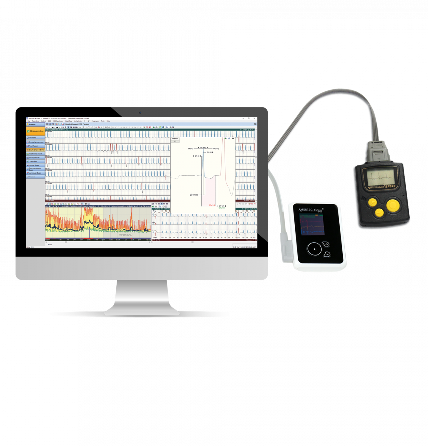 Holter ECG - hospital - AMEDTEC medical technology made in Aue