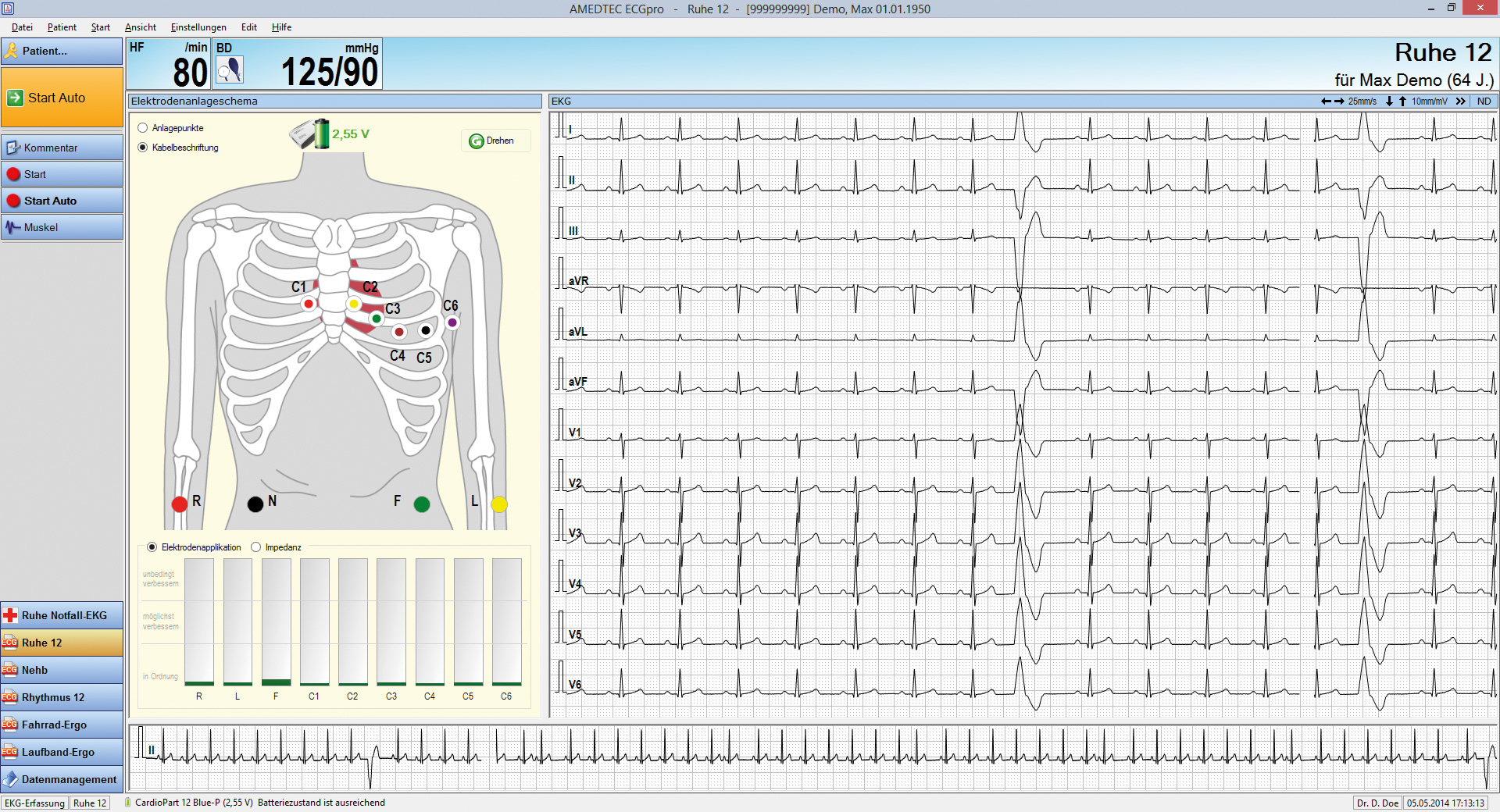 Ruhe-EKG - MVZ und Praxen - AMEDTEC Medizintechnik Aue GmbH