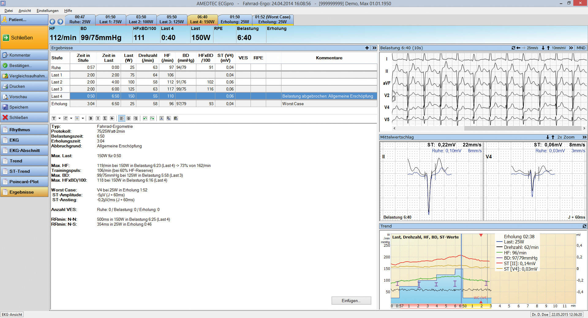 AMEDTEC - Stress Test ECG